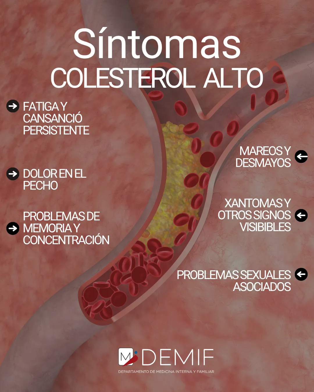Síntomas del colesterol alto: Señales que no debes ignorar - TRUCOS TV